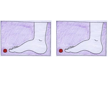 Plochá noha u dětí. | Babyonline.cz